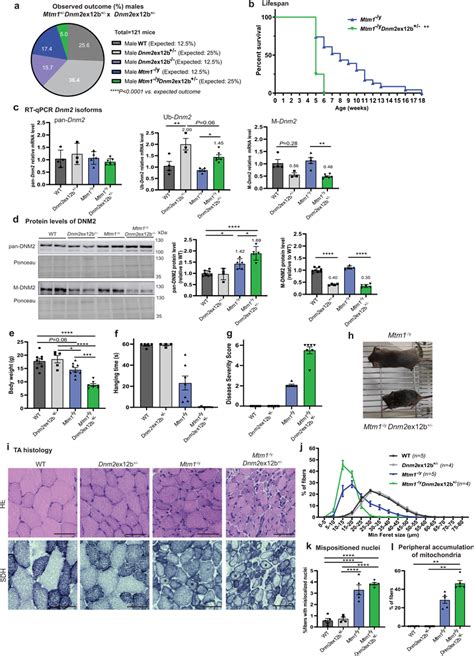 Dnm2 Splice Switching Towards Ubiquitous Isoforms Is Worsening Xlcnm