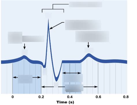 Electrocardiogram Diagram Quizlet