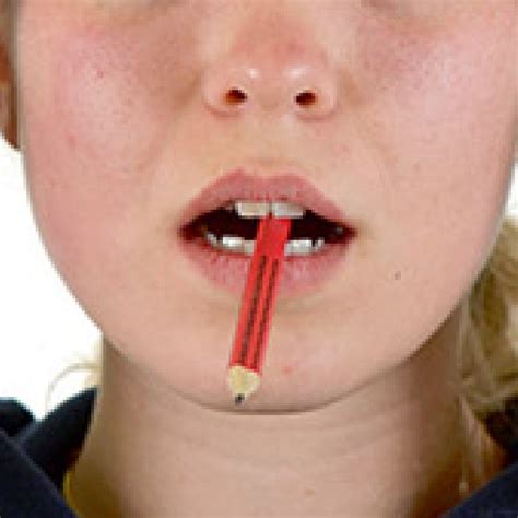 What Is A Sleep Clench Inhibitor For Bruxism By S4s S4s Dental