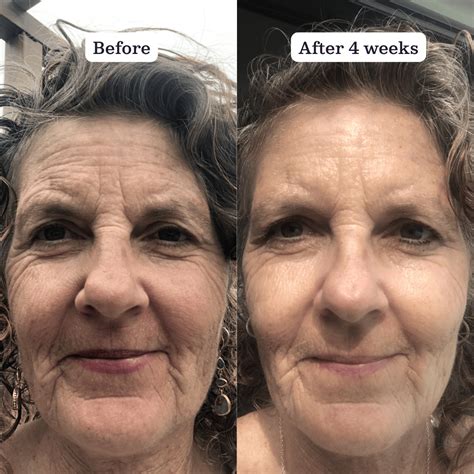 Stem Cell Concentrate Advanced Spermidine Anti Ageing Formula