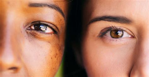 Researchers Need To Rethink And Justify How And Why Race Ethnicity