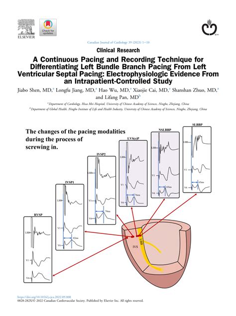 Pdf A Continuous Pacing And Recording Technique For Differentiating