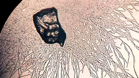 플라스틱 먹는 곰팡이와 박테리아 쓰레기 줄일 대안 될까 Bbc News 코리아