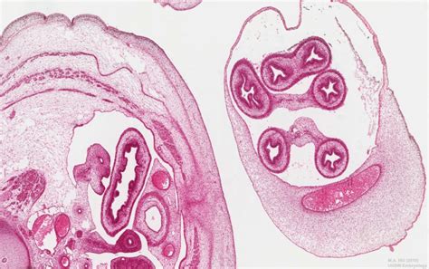Coelomic Cavity Development Embryology