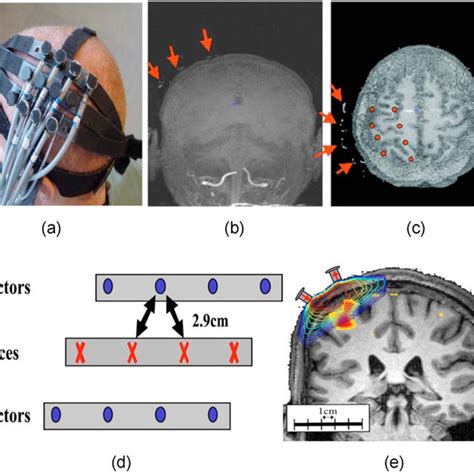 Diffuse Optical Tomography Diffuse Optical Tomography Uses