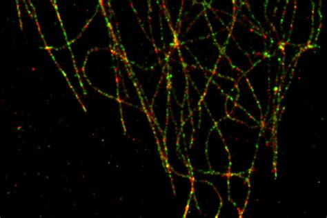 Zeiss Elyra 7 Super Resolution And Single Molecule Localization Microscope
