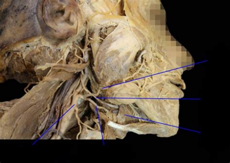 Inferolateral Head And Neck Bluelink Diagram Quizlet