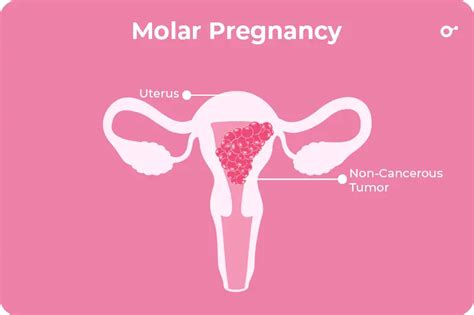 Is Heavy Implantation Bleeding Normal