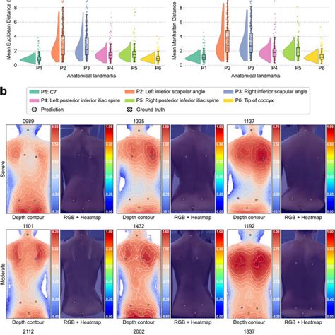 Statistical Analysis And Visual Results Of The Landmarks Detection On