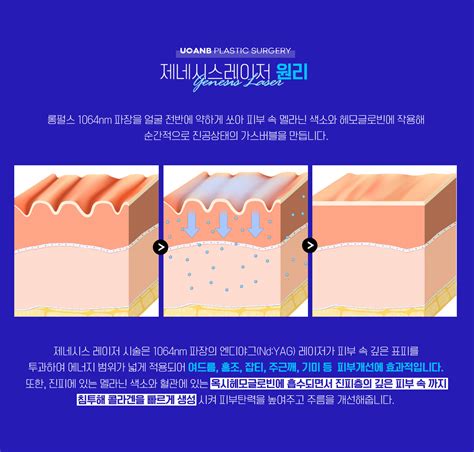 피부과 제네시스