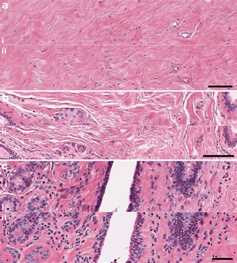 A And B Comparisons Of Deep Learning Enabled Virtual Histology Images Download Scientific