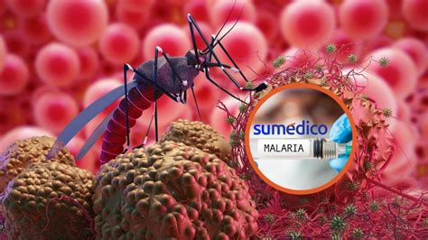 Sensor Molecular Podr A Evitar Que La Malaria Cause Da Os En La Salud