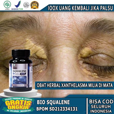 Jual Obat Xanthelasma Gumpalan Lemak Di Kelopak Mata Obat Penghilang