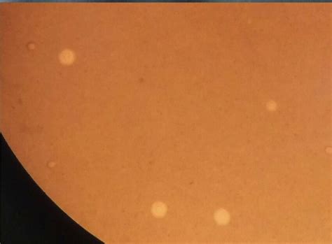 Picture Of Cryptococcus Neoformans In India Ink Download Scientific Diagram