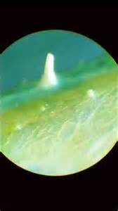 Exploring The Grip Of Death Praying Mantis Leg Under A Microscope