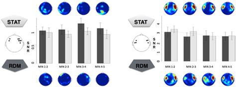 Temporal Dynamics Of Tritone Snr Left And Tone Snr Right During The Download Scientific