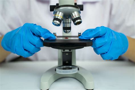 How Itp Is Diagnosed