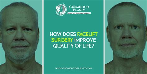 Breast Capsular Contracture Its Causes Symptoms And Treatment