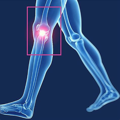 Arthogram Spring Hill Mri And Imaging