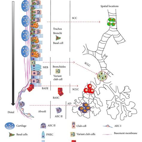 Illustration Of Epithelial Stem Cells And Lung Cancers Along Airway