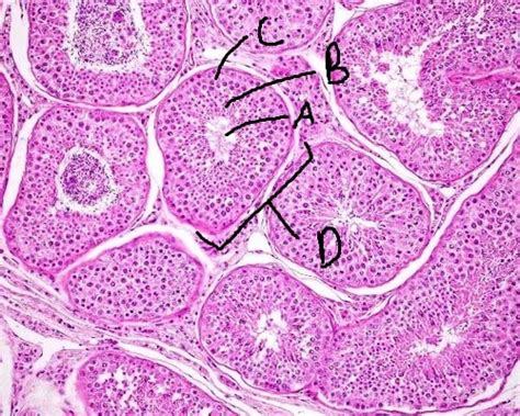 Lab Practical Exam Flashcards Quizlet