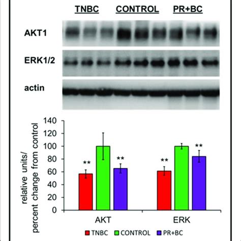 Levels Of 4 Hydroxy 2 Nonenal 4 Hne In The Hippocampal Tissues Of