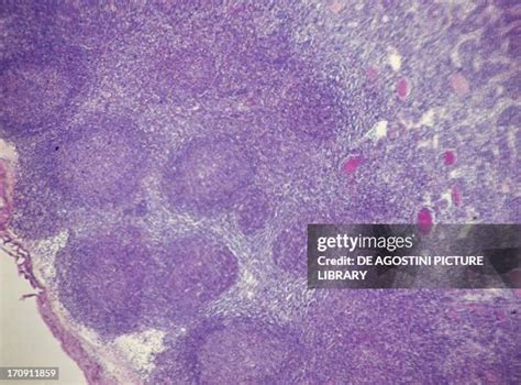 Lymph Node Cross Section Photos And Premium High Res Pictures Getty