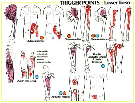 Sartorius Trigger Points