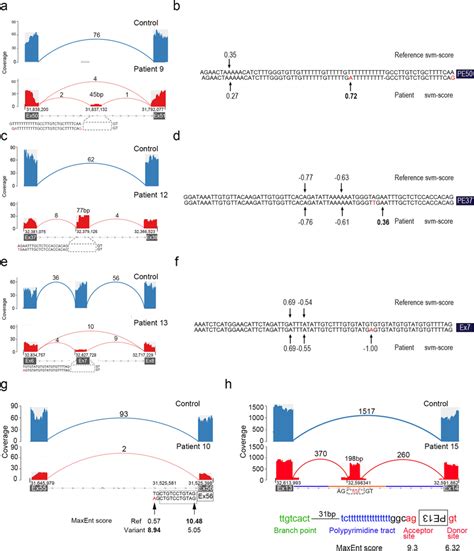 In Silico Analysis Of Data From Patients 9 12 13 10 And 15 A C E