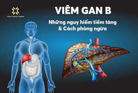VIÊM GAN B Những nguy hiểm tiềm tàng Cách phòng ngừa Dược sĩ Việt