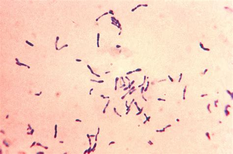 Corynebacterium Propinquum
