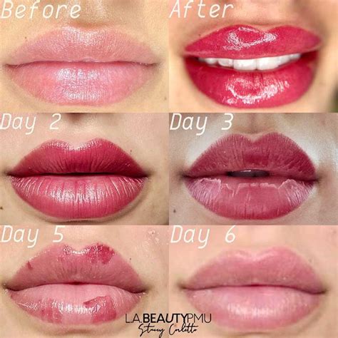 Aggregate More Than 60 Lip Tint Tattoo Aftercare Latest Incdgdbentre