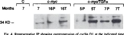 Figure 1 From Disruption Of The Prb E 2 F Pathway And Inhibition Of Apoptosis Are Major