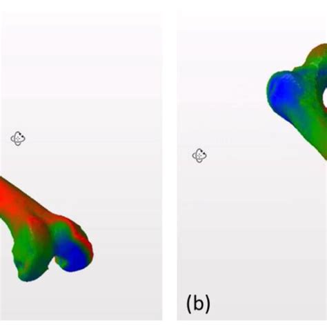 overlapping of both femurs of one patient using automatic alignment