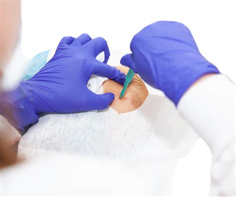 Biopsy Understanding The Procedure And Its Importance