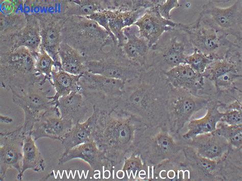 Hs578t 人乳腺癌细胞（str鉴定）艾碧维生物官网