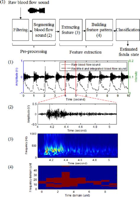 Figure 1 From Novel Noninvasive Approach For Detecting Arteriovenous