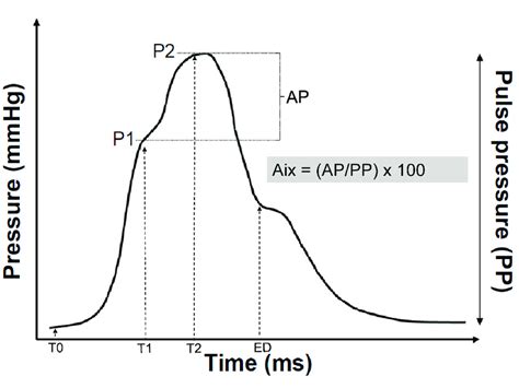 Schematic Presentation Of The Pulse Wave Curve Measured At The A