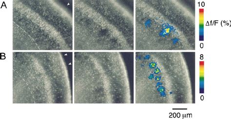 Neuronal Domains In F Ura 2 Stained Slices In Neonatal Rat Visual Download Scientific Diagram