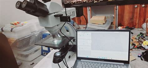 Particle Analyzer Microscope Shreyal Medico Lab Industries