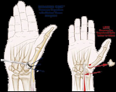 Patient Ensemble Orthopedics