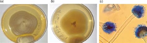 Figure 1 From Isolation And Morphological Identification Of Aspergillus Species From Some