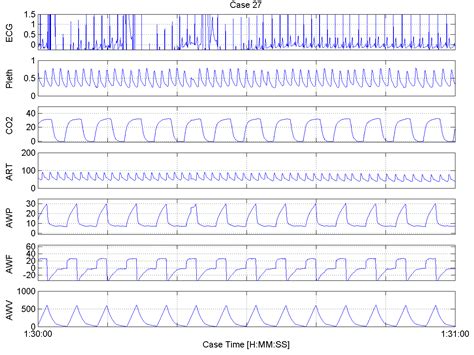 Case 27 Waveform Plots 60 Second Plots