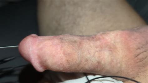 Rosebud Sounding With Tens And Fucking Machine Free Sex Video Redtube