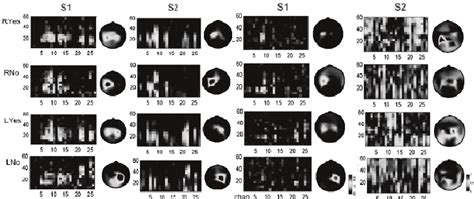 feature visualization indexed by bhattacharyya distance for healthy