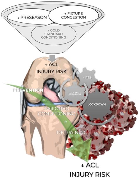 Assessment Of The Risk Of Anterior Cruciate Ligament Injury During The