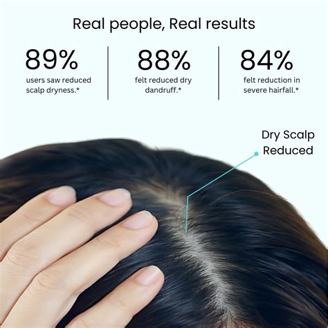Dry Scalp Relief Lotion 300 Ml