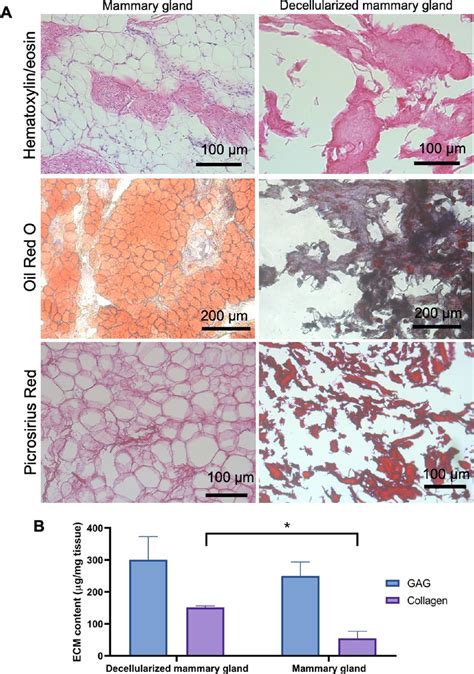 A Histological Comparison Of The Native Porcine Breast Tissue Left