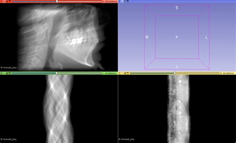 Ct Reconstruction Using Slicer And Rtk