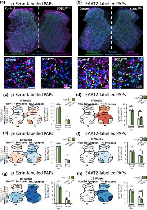 Mapping Tripartite Synapses In The Sod1g93a Mouse Spinal Cord A